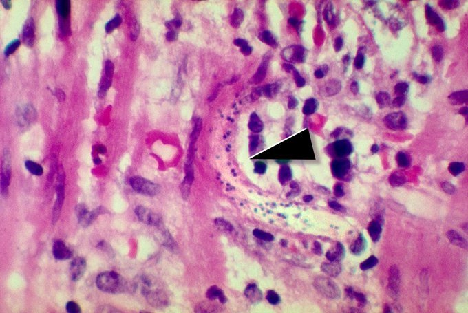 Dogs 101: Treating Internal Parasites - DogTime