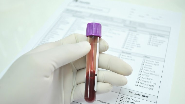 Titer Testing For Dogs: What Is It, And What Does It Mean For Yearly ...