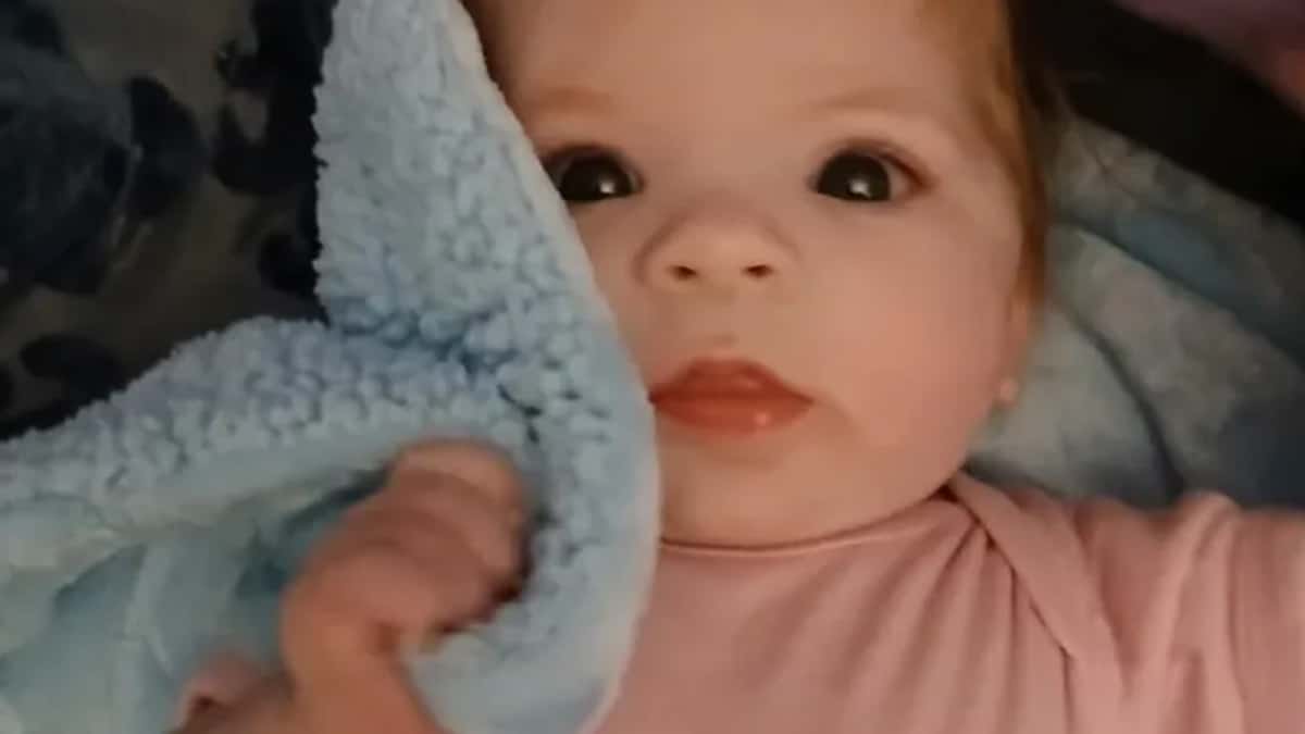 Why the Ember Southard Dog Attack Was 'Avoidable' According to Victim's ...